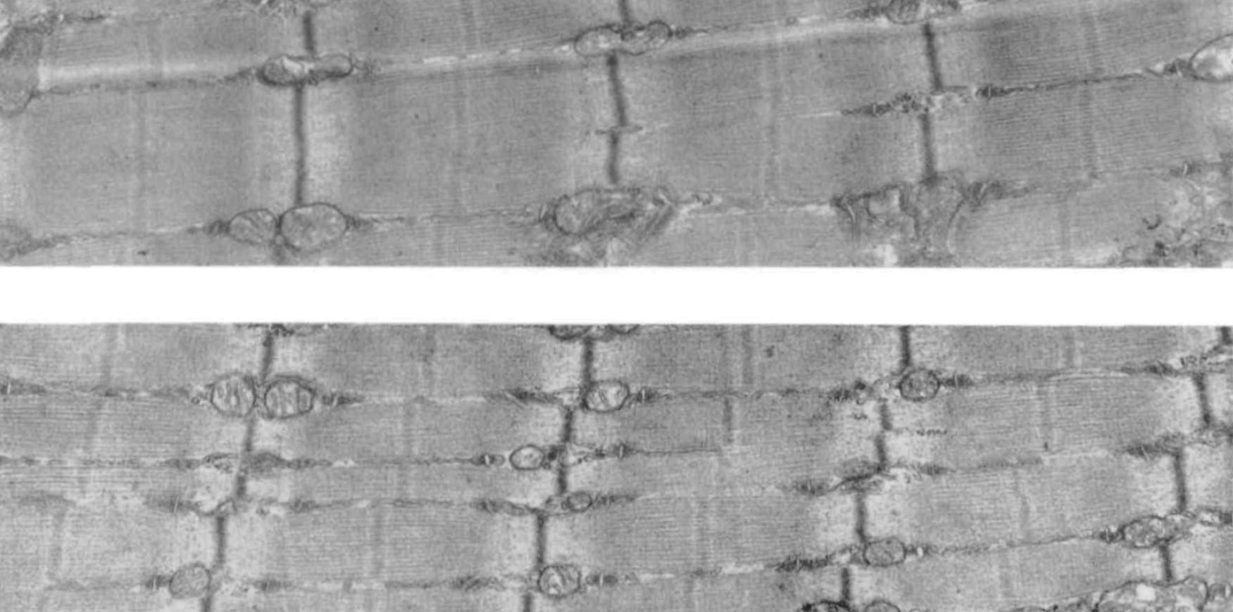 Пролиферация (деление) миофибрилл